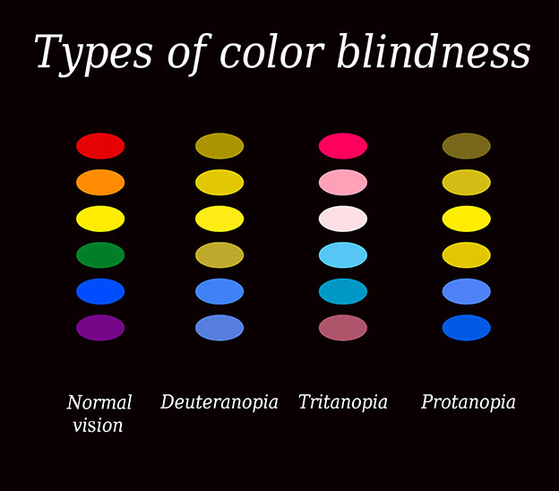 Color Blindness - South Gate Optometry